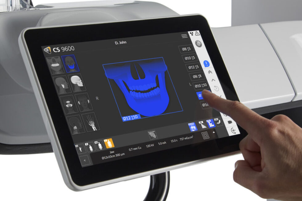 Carestream CS 9600 | Macor
